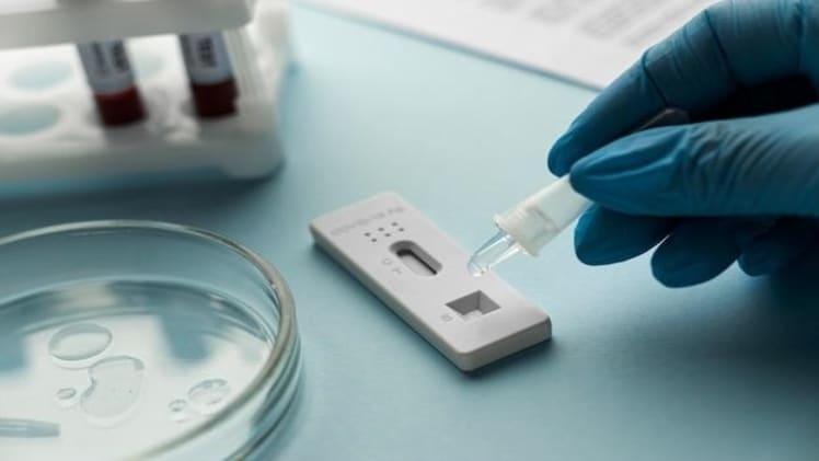 How to Implement Random Employee Drug Testing Legally: A Step-by-Step ...